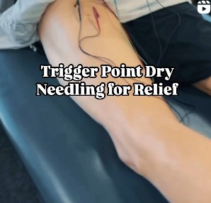 ActiveTherapy Alliance